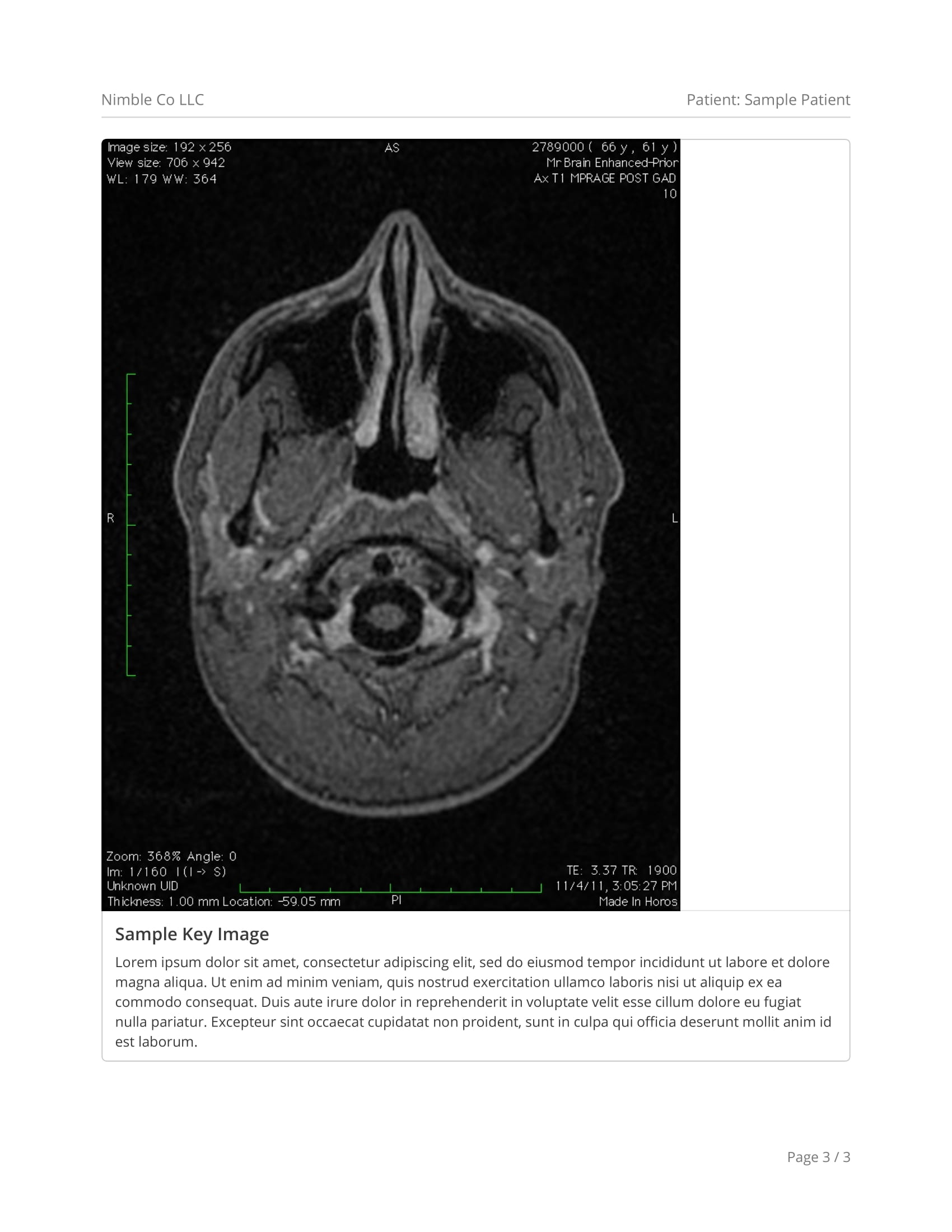 Radiology Reports with Key Images Improve Communication